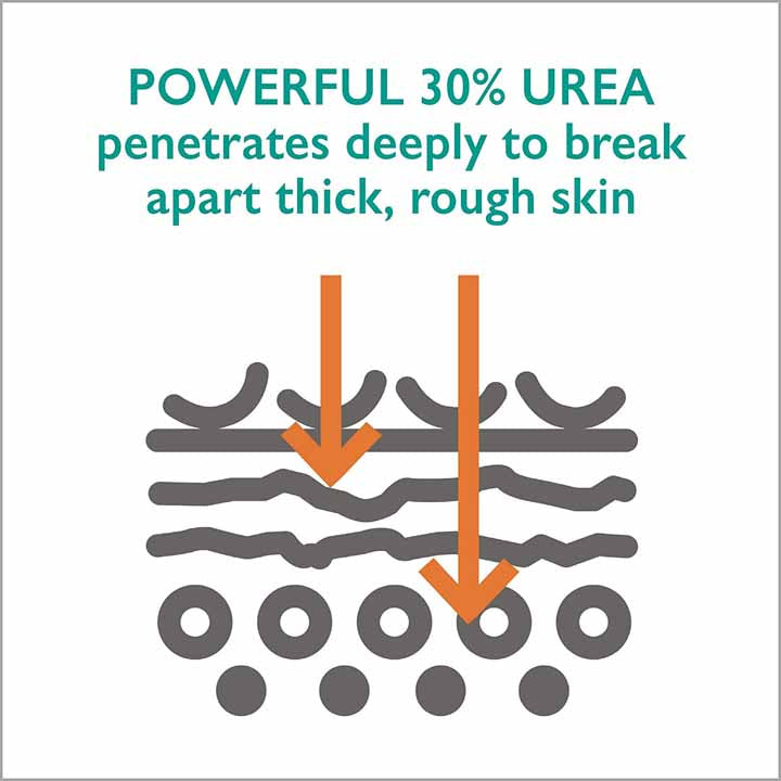 Gilden Tree | 30% Urea in Easy-to-use Callus Remover Stick